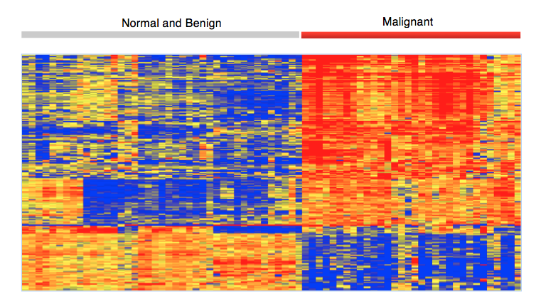 The Paradise Genomics Biomarker for Malignant Colon Tumors